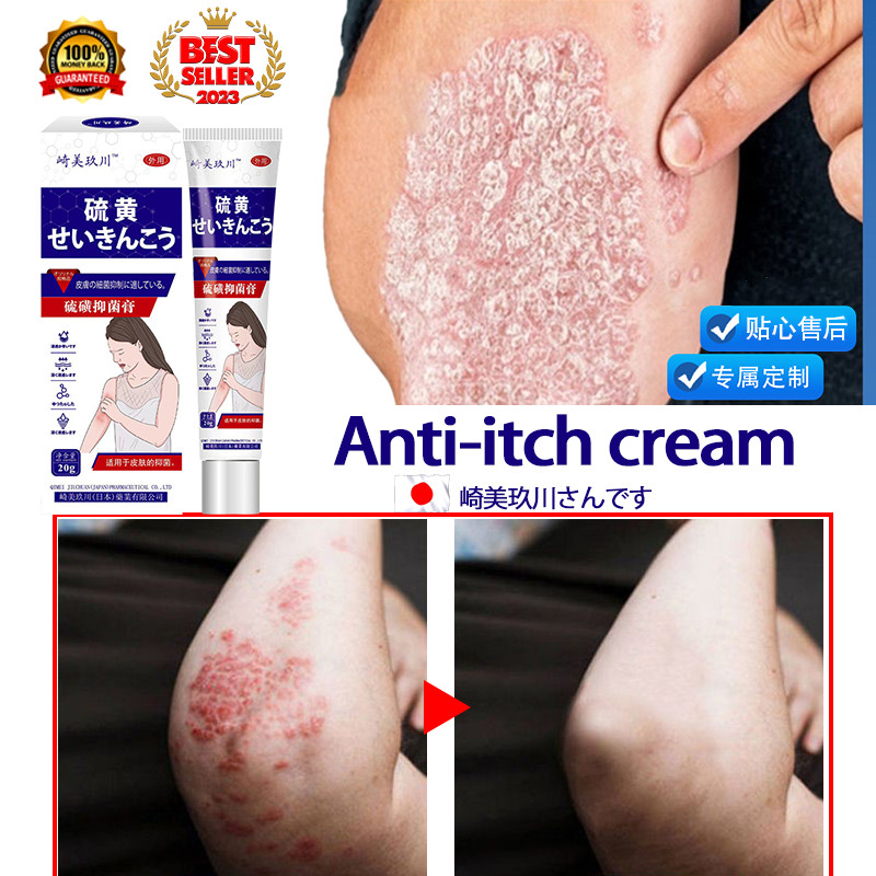 Japan anti itch antifungal cream 止癢膏 anti viral relief itchy redness peeling relief eczema skin ...