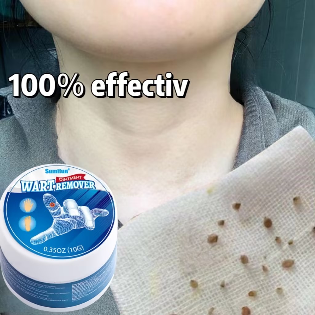 Warts Skin Tags And Mole Remover Original Cream Wartz Removal Ointment ...