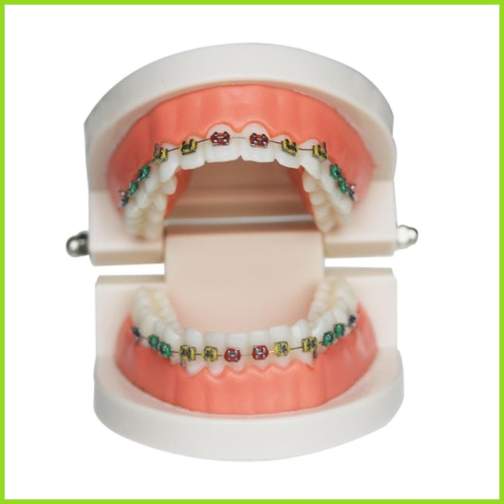 Fake Braces Kids Fake Braces Colorful Braces Wire Braces Lip Protector ...