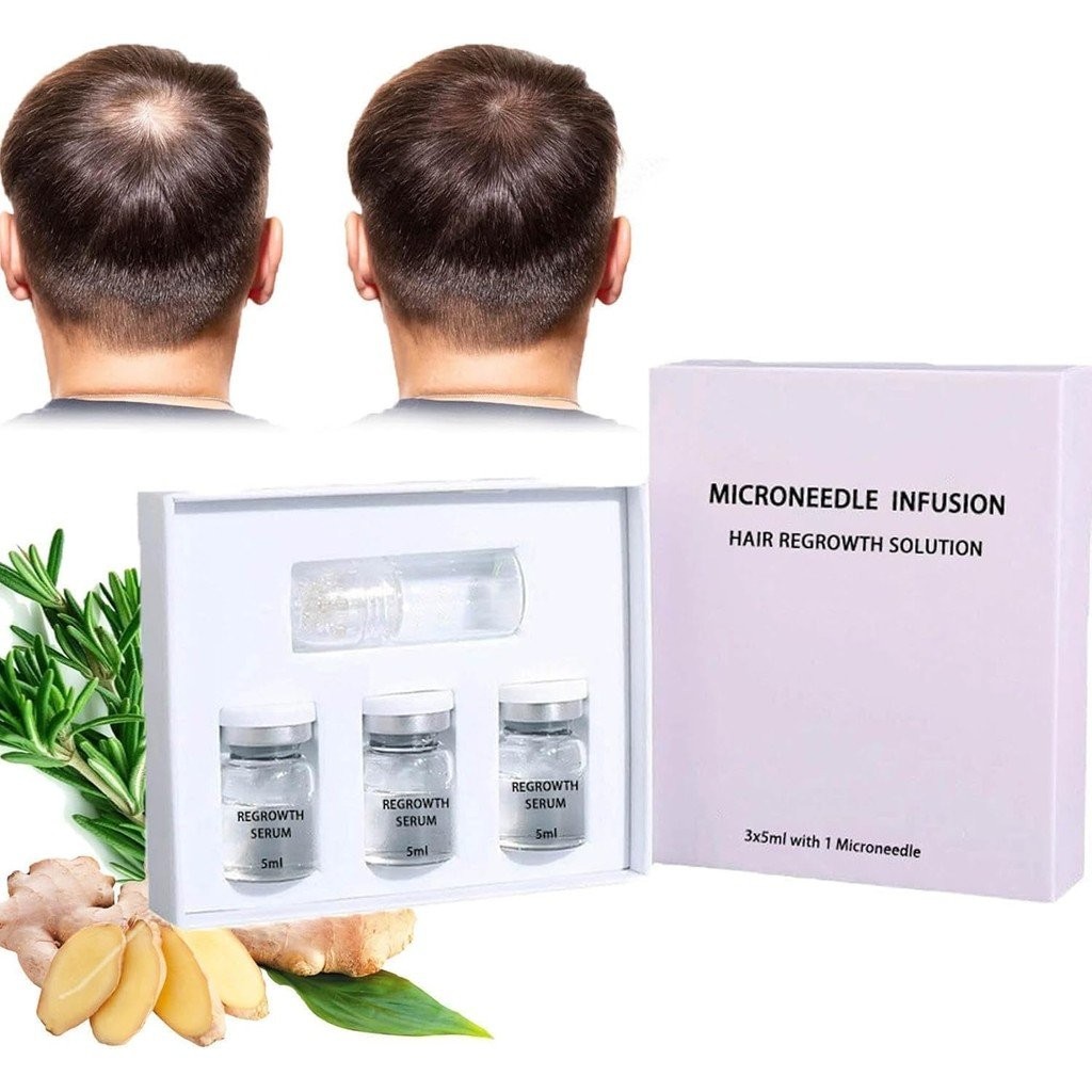AlphaInfuse Hair Regrowth System, ALPHA INFUSE Microneedle Infusion ...