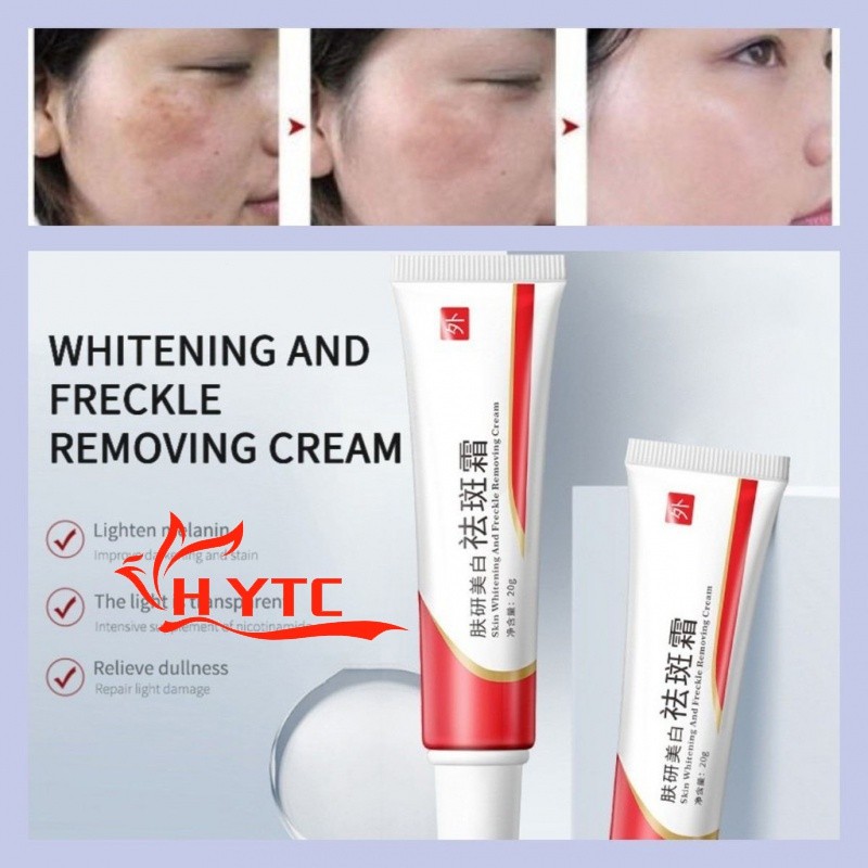 [Ready] Whitening Cream Dark Spot Corrector Skin Whitening Fade Cream Lightening Blemish Removal ...