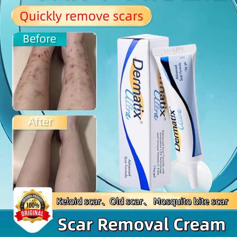 Scar Removal Cream Keloid Scar Removal dermatix ultra Scar Gel Acne ...