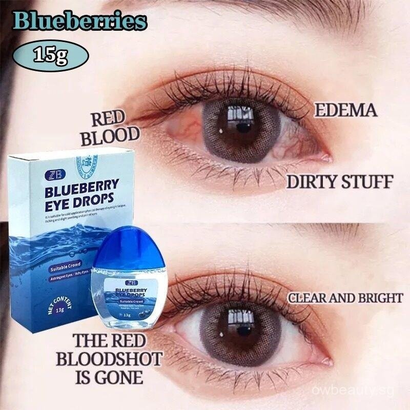 Blueberry Eye Drop Eye Care Original Blurred Vision Dry Itchy Eyes ...