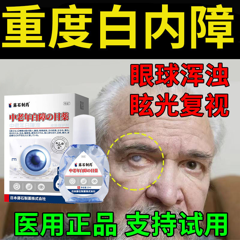 Cataract Eye Drops Middle-Aged and Elderly People Blurring of Vision ...