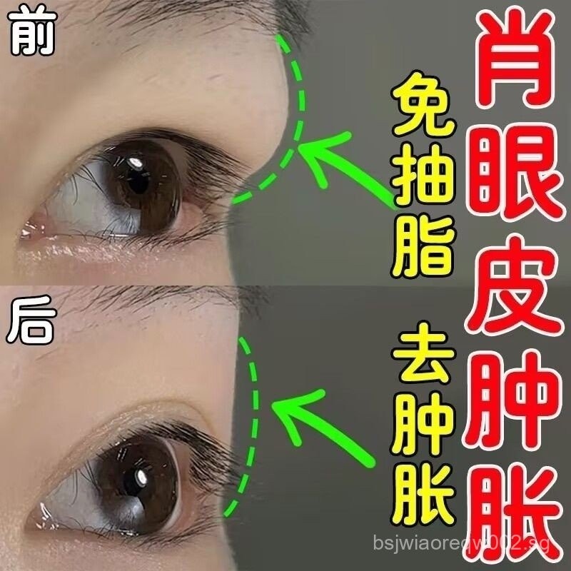 2Send1Swelling Bubble Eye Killer Anti-Puffy Detumescence Bubble Eye ...
