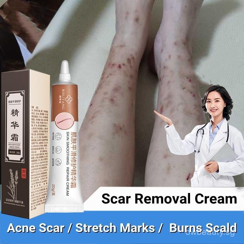 Skin Smoothing Essence Cream Scar cream Scar Removal Cream Keloid Scar ...