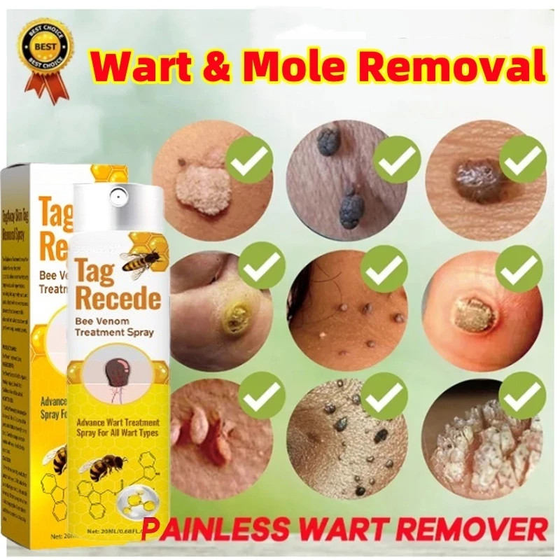 Bee Venom Remover Skin Tag Remover Useful Bee Venom Spray Tag Recede ...