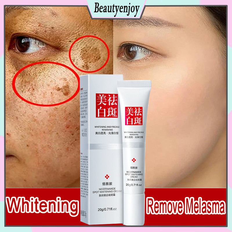 Nicotinamide Whitening Freckle Cream Effective Removing Age Dark Spots ...