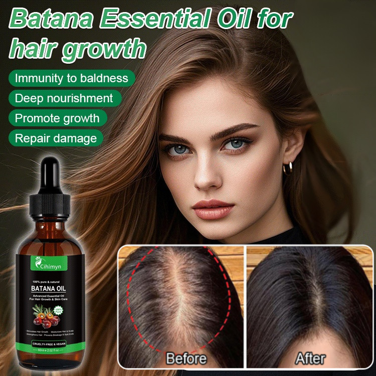 ️Ready Stock ️Batana Oil Hair Growth Serum / Repairing Split Ends Hair ...