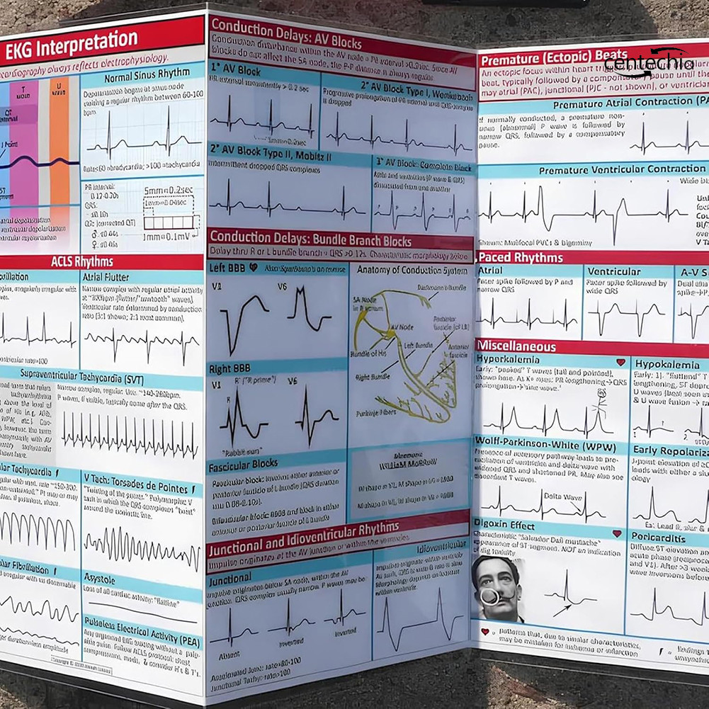 EKG Pocket Guide Professional Pocket EKG Reference For Nurse | Shopee ...
