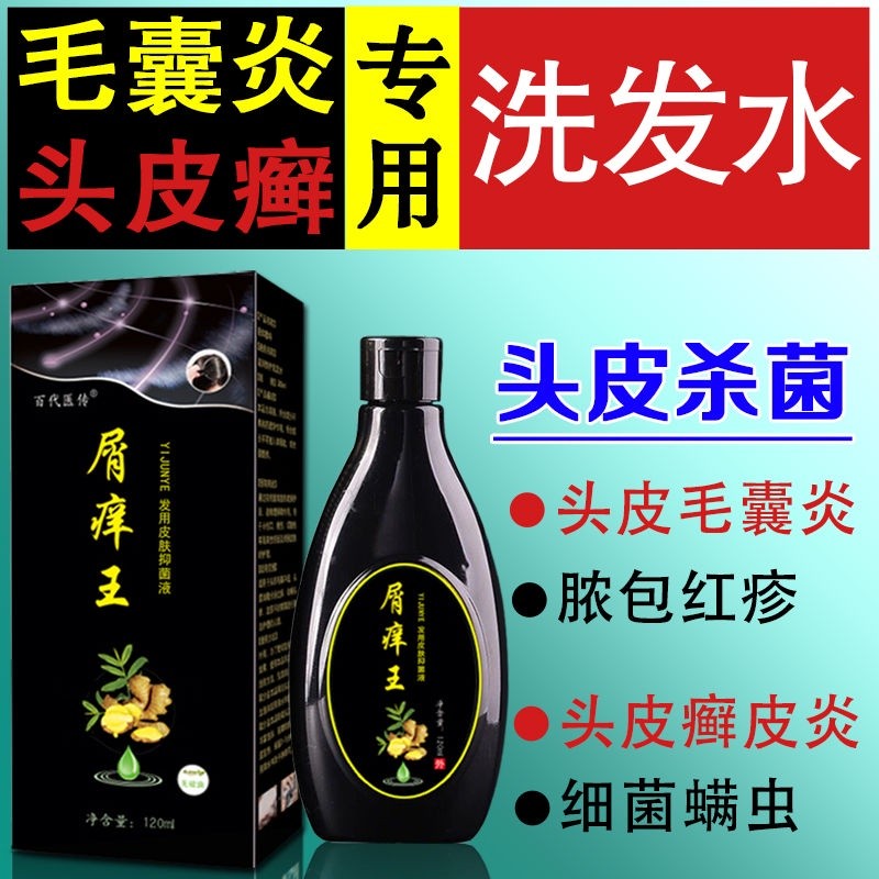 Scalp folliculitis scalp ringworm dandruff head dermatitis pustules ...