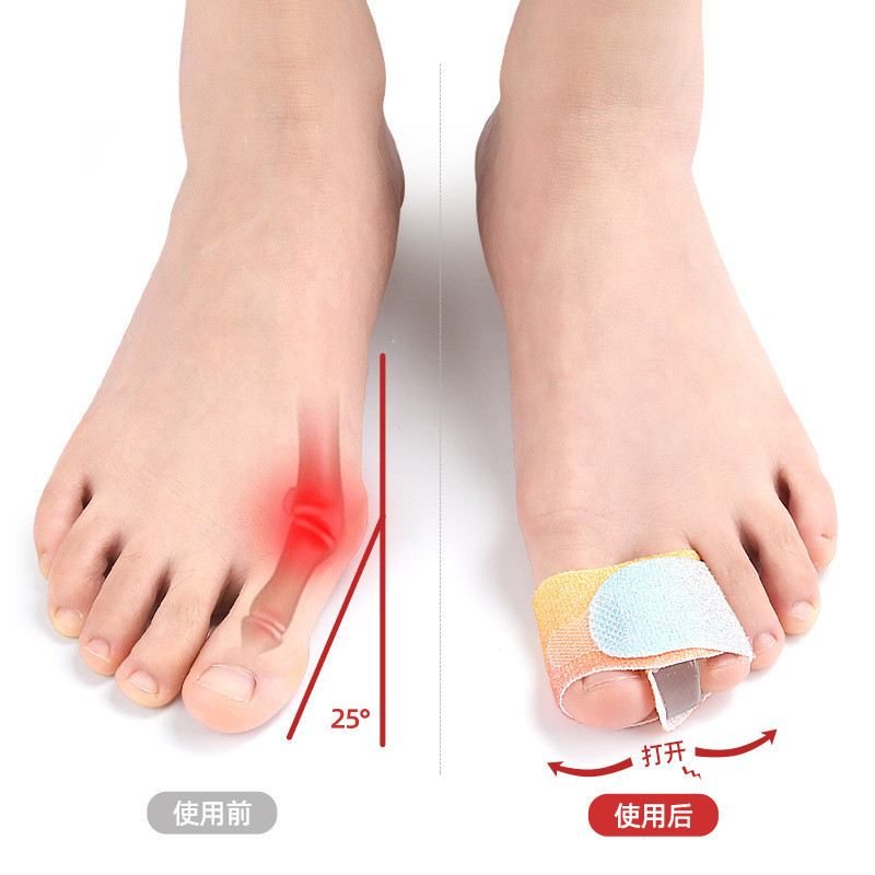 2025 New Color Toe Splitter Thumb Valgus Overlapping Toe Splitter Strap ...
