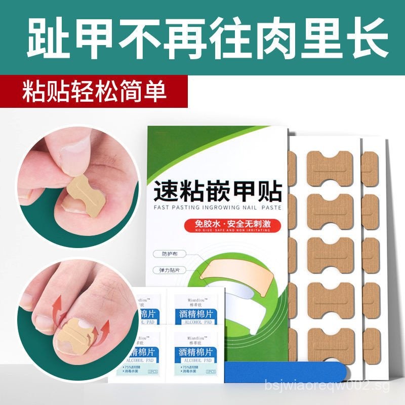 Paronychia Correction Device Ingrown Nail Nail Braces Big Toenail Long ...