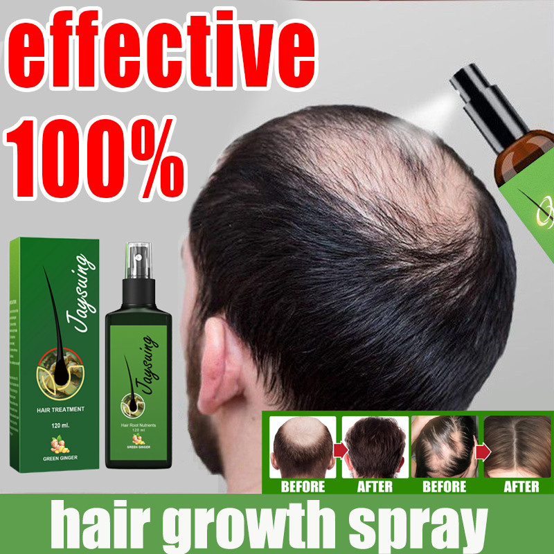 Hair Growth Spray Bald Hair Growth Serum Hair Tonic Serum Hair Growth ...