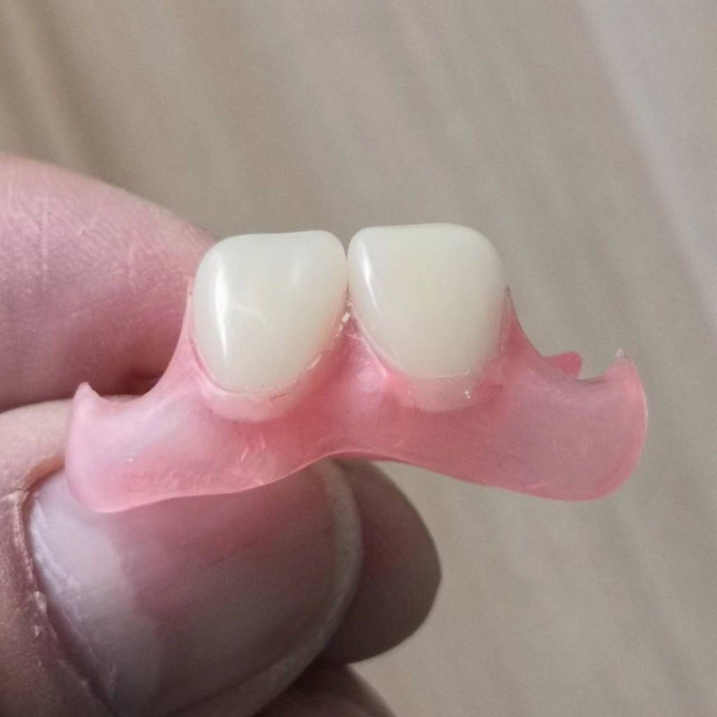Oral denture complete set of impression materials manual manual ...