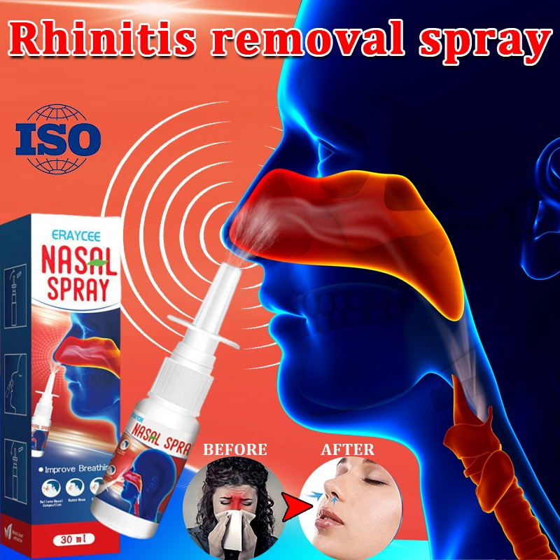 [24H Ship Out] nasal spray 30ml blocked nose rhinitis spray allergic ...