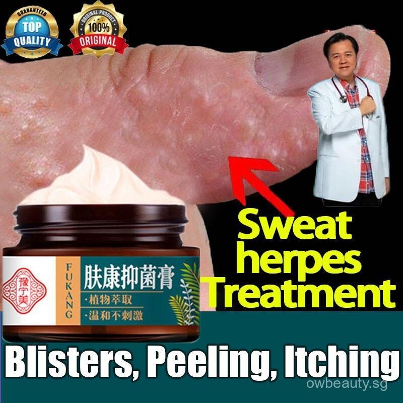 Psoriasis Eczema Cream Antibacterial Anti-Itch Cream Dermatitis Rash ...