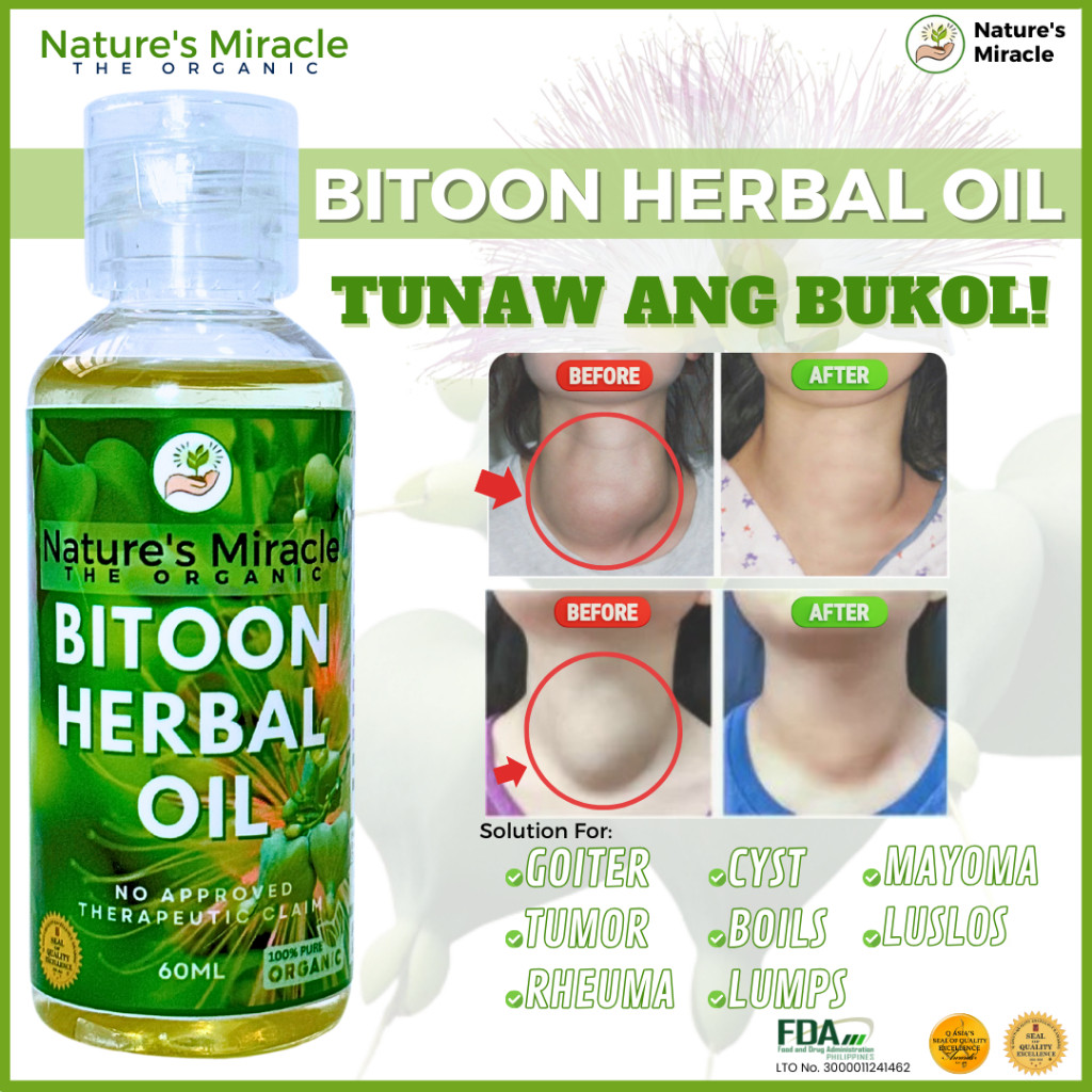 Bitoon Herbal Oil Original For Bukol Pang Tunaw ng Bukol Goiter Cyst Myoma Rheumatism | Shopee ...