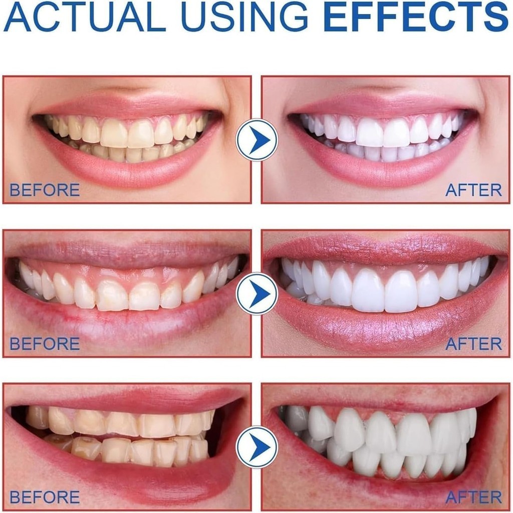 Sp-6 Ultra Whitening Toothpaste, sp6 Probiotics Bright White Toothpaste ...