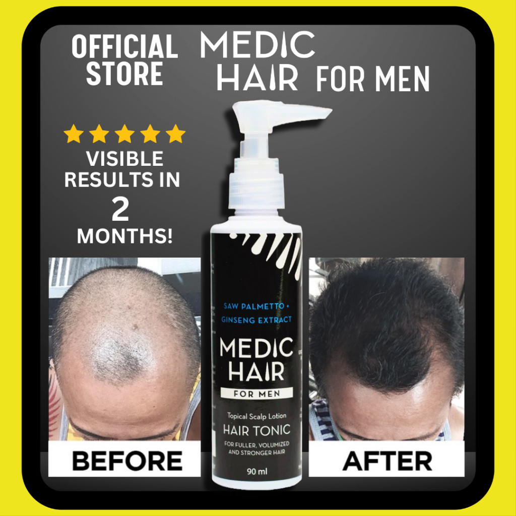 Use Before March 2026 - Medic Hair for Men - Hair Regrowth Formula ...