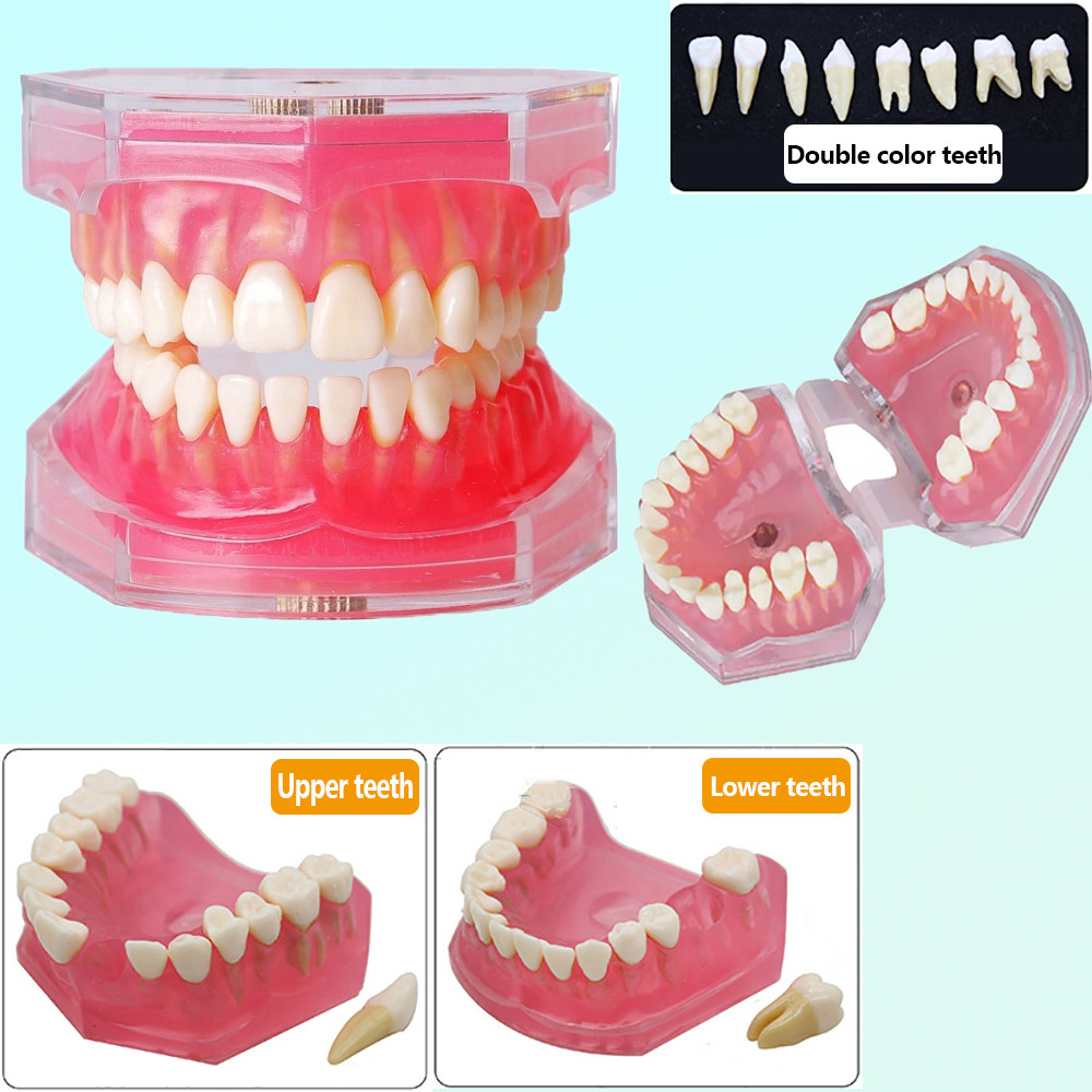 (In Stock)Dental Teeth Model Removable teeth Dental Model With ...