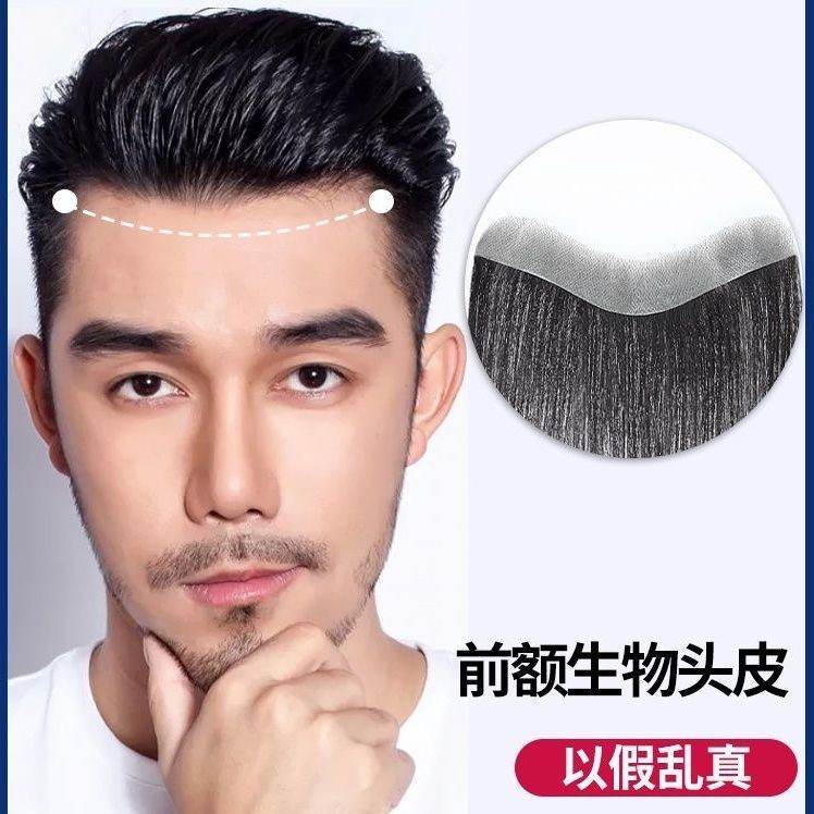 现货 Hairline Wig Sticker Men's Forehead Men's High Forehead Men's Bald ...
