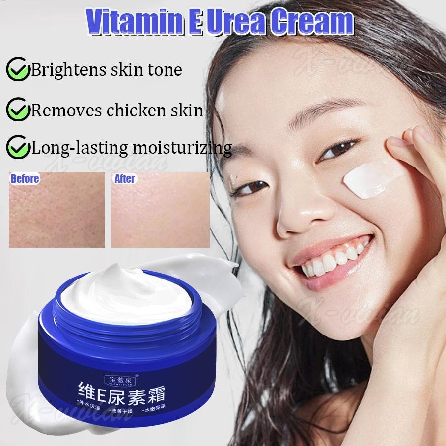 Vitamin E Urea Cream Hydrating Urea Lotion Mild Nourishing Face Cream ...