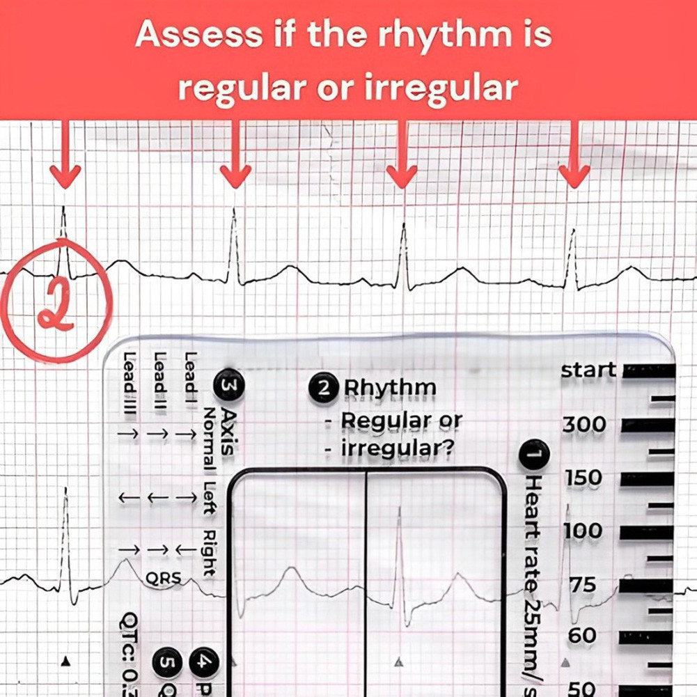ECG 7 Step Ruler Portable ECG Measuring Card Reference Tool for ECG ...
