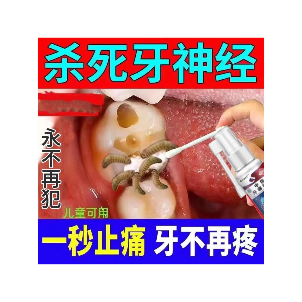Toothache Toothache Pain Relief Potion Quick-Acting Spray Ning Killing ...