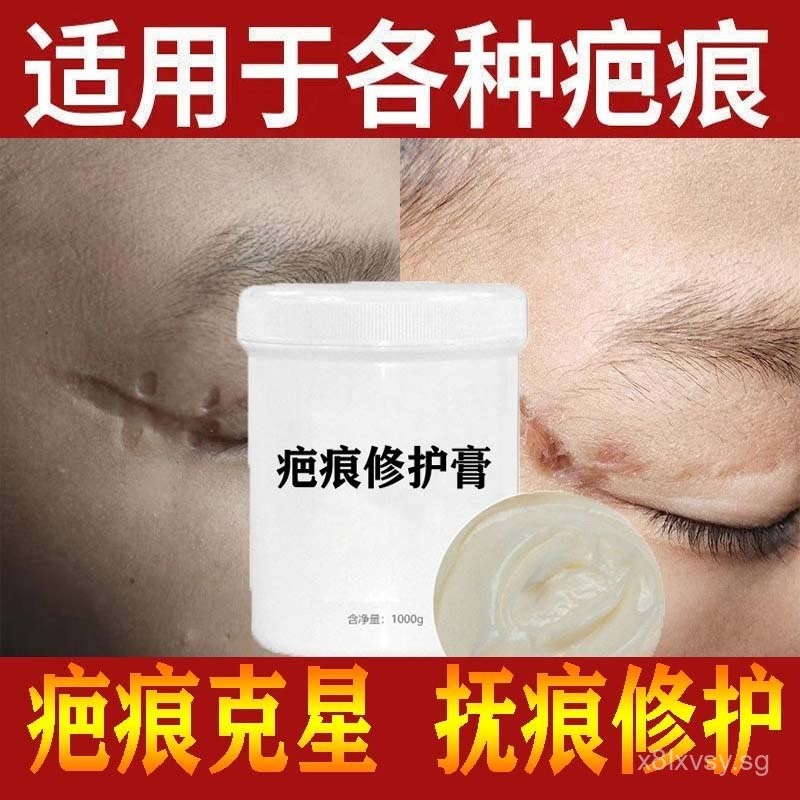 Anti-Acne Cream Concave-Convex Repair Surgery Scar Renchen Lines Marks ...