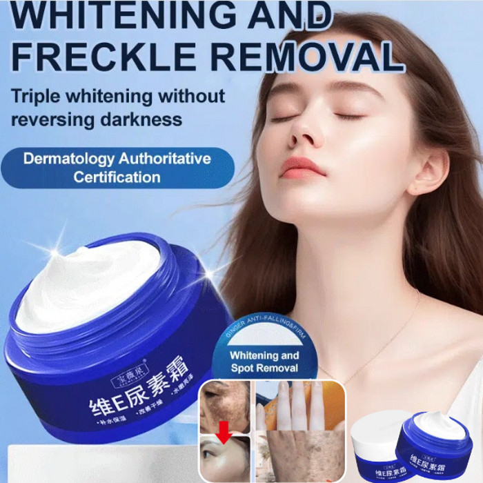 Removal[Old Spots and Yellow Spots Disappear] Spot Fading Urea Cream ...