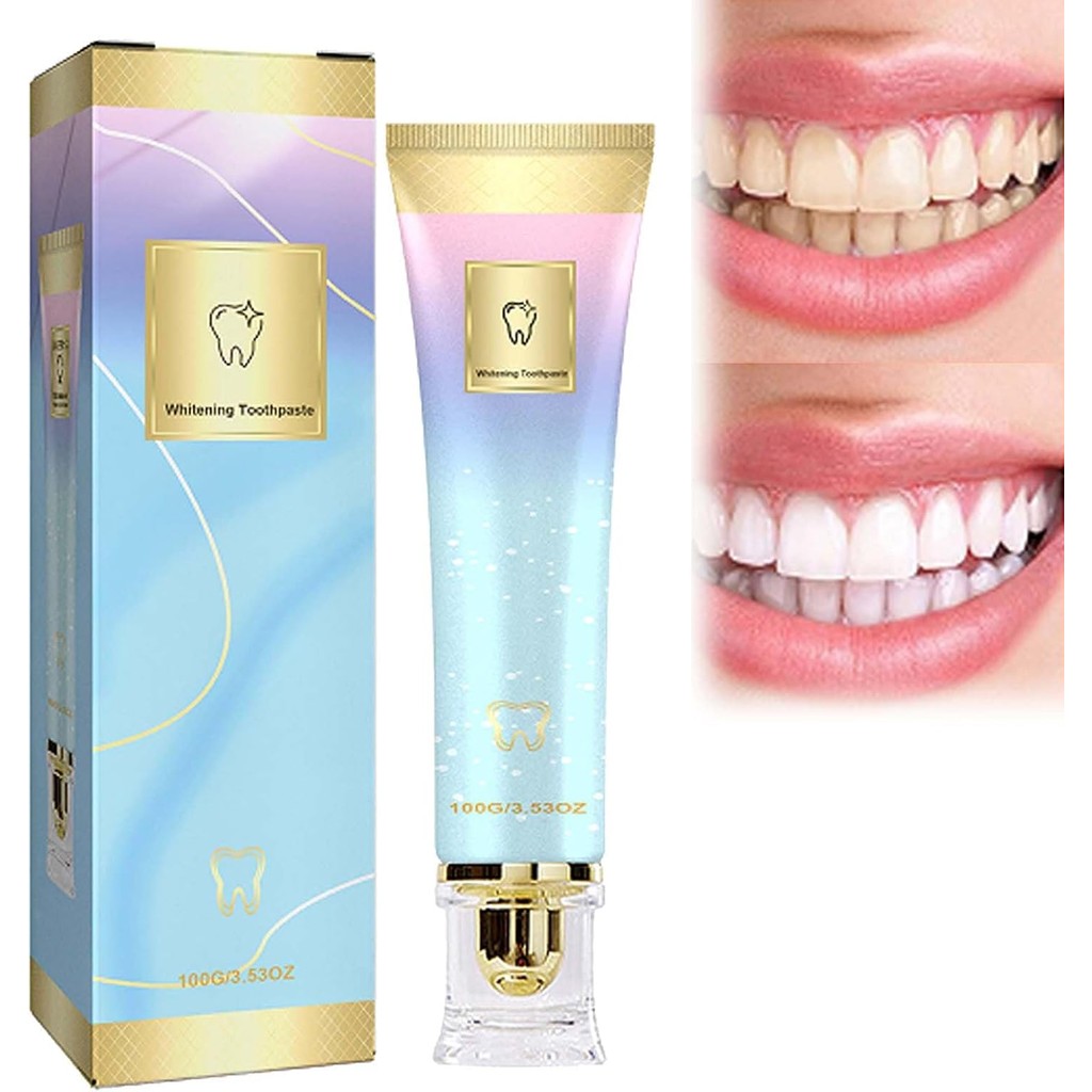 Niacinamide Whitening Toothpaste,Teeth Whitening Toothpaste,Intensive ...