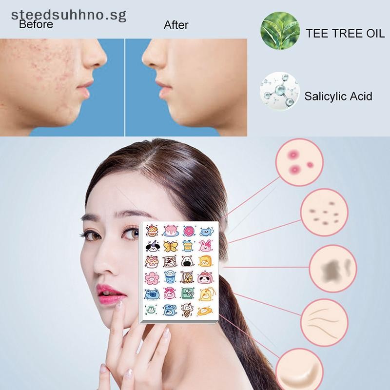 STE 96pcs Acne Patches Cartoon Cat Shaped Acne Treatment Sticker ...