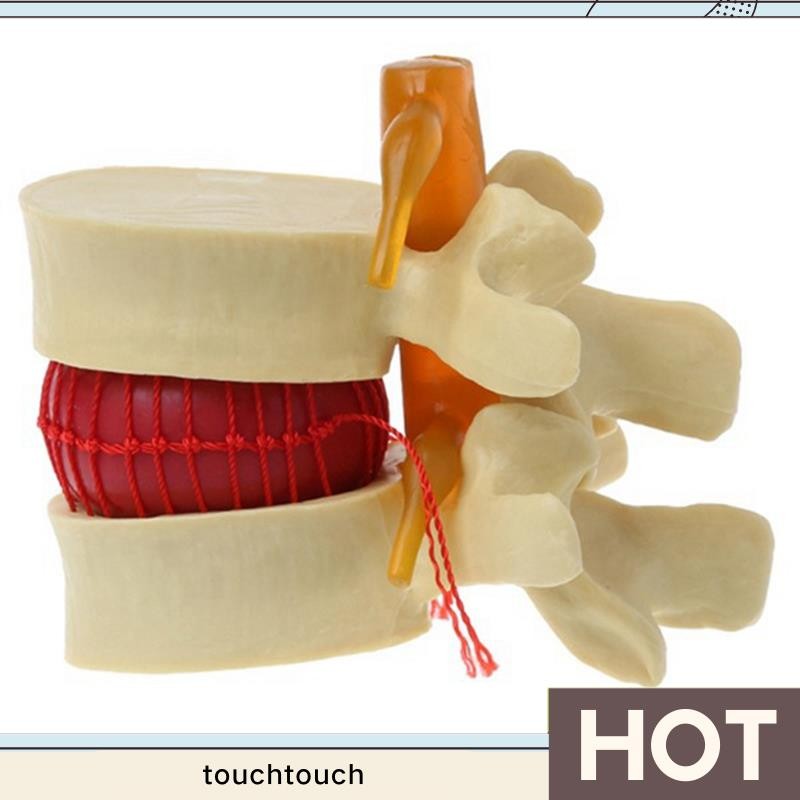 Lumbar Vertebrae Model Anatomical Spine Lumbar Disc Herniation Anatomy ...