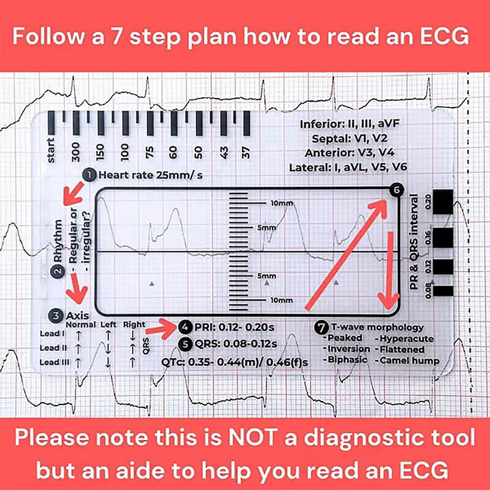 Electrocardiogram 7 Step Ruler For EKG Interpretation Transparent EKG ...