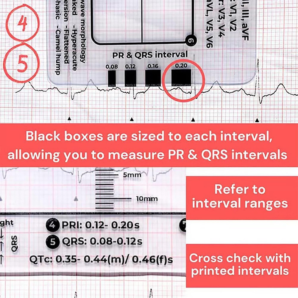 Electrocardiogram 7 Step Ruler For EKG Interpretation Portable Ecg ...