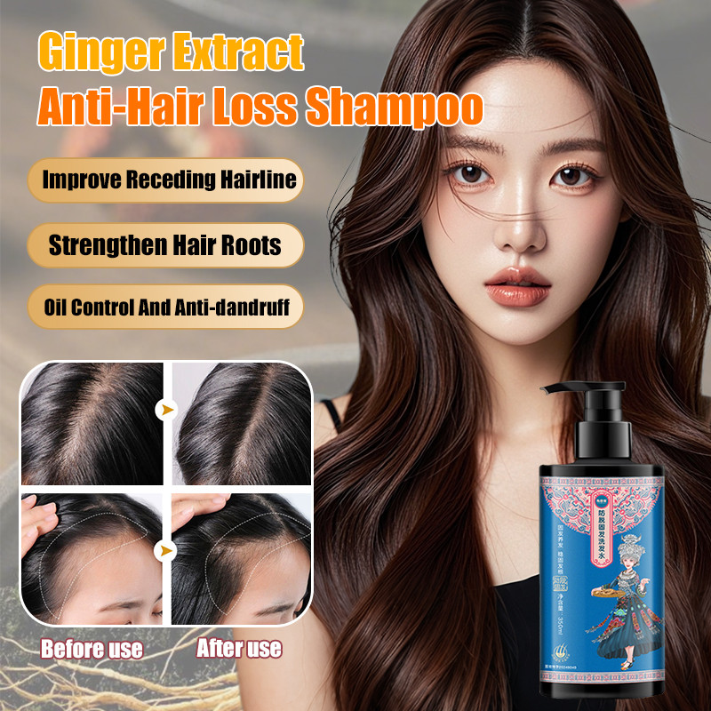 Hair loss prevention and hair care shampoo Antihair loss shampoo ...