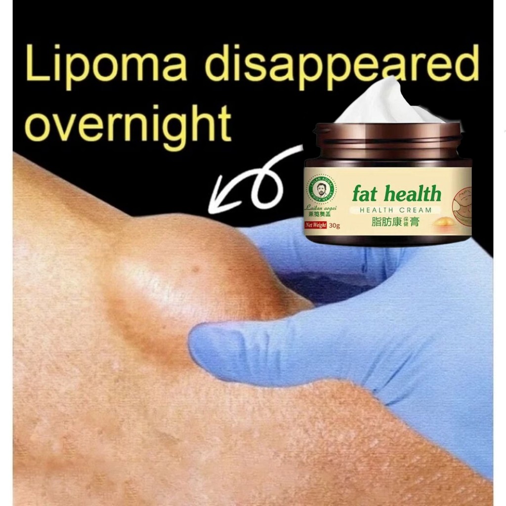 lipoma removal cream Lymph Care Lymph Node Dissolving Health Cream ...