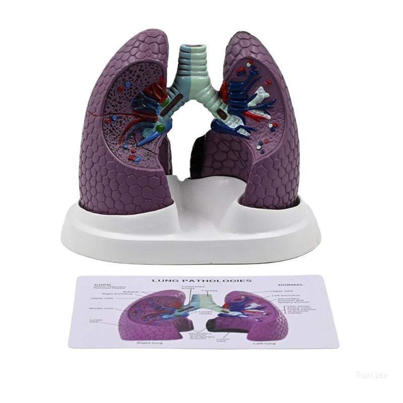 Top Human Lung Model Normal and Pathological Lung Anatomy Model for ...