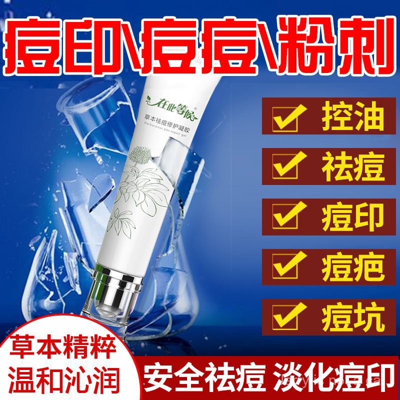 Acne Removal Aloe Vera Gel Acne Marks Acne Treatment Cream Acne ...