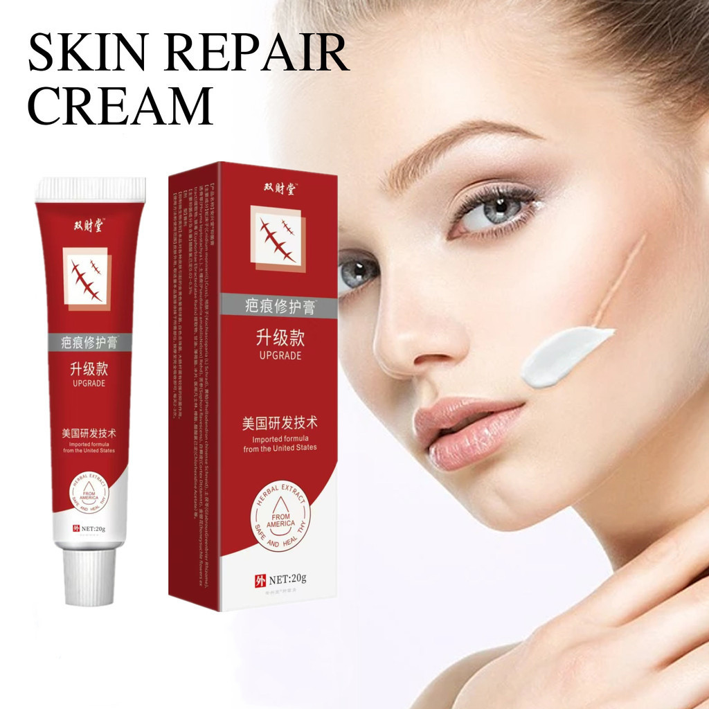 Scar Repair Cream 20g Fade Scar Marks Stretch Marks Acne marks Inhibit ...