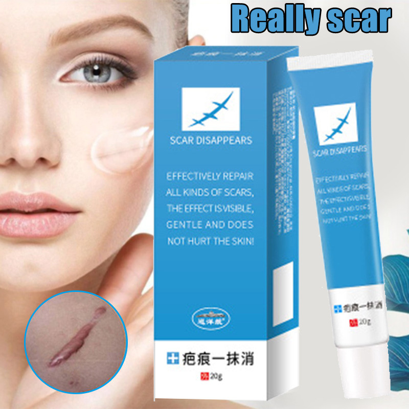 Face & Body Scar Repair Skin Care Gel Natural Ingredient Effectively ...