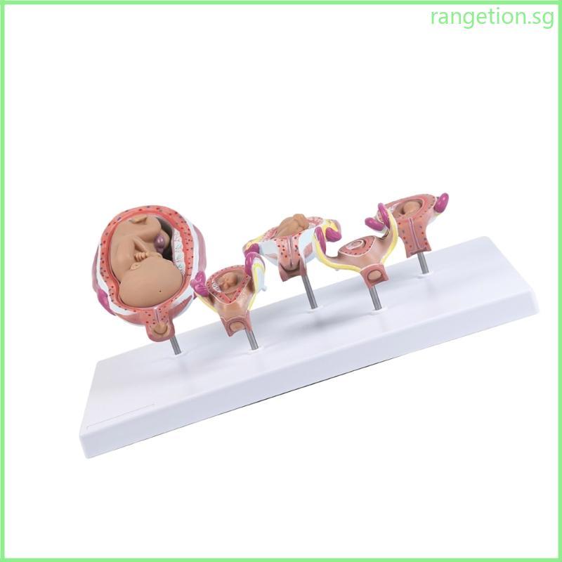 RAN Development Five Part Detachable Model Realistic Anatomy for ...