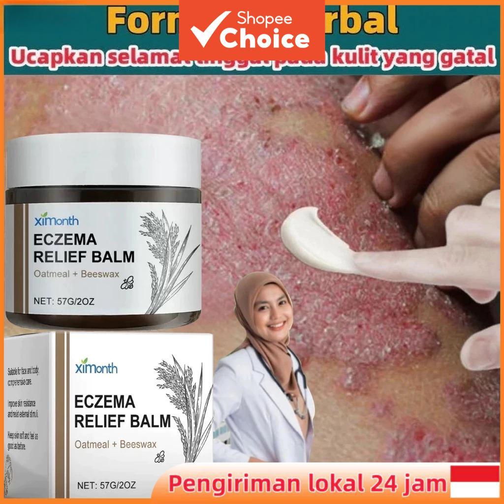 Eczema Cream Mild Soothing Eczema Nourishing Skin Itching Redness ...