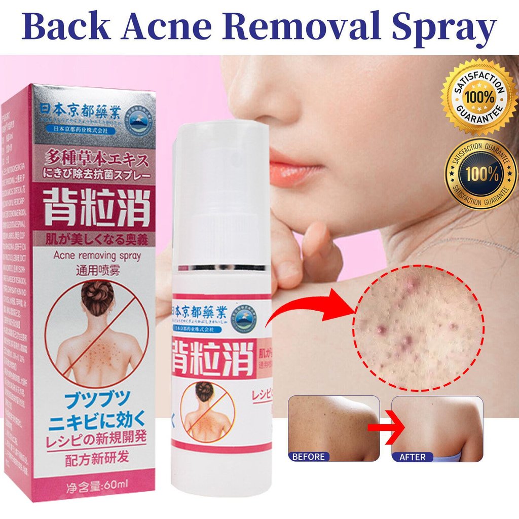 100% Effective Back acne care spray Back grain spray Eliminate acne ...