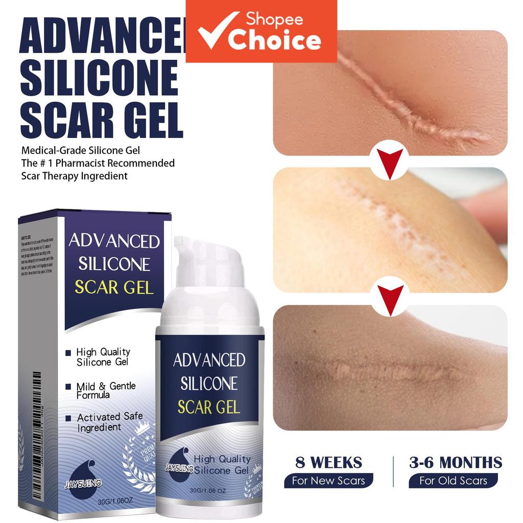 Hot Silicone Scar Cream with Medical Grade Silicone Stretch Mark Cream ...