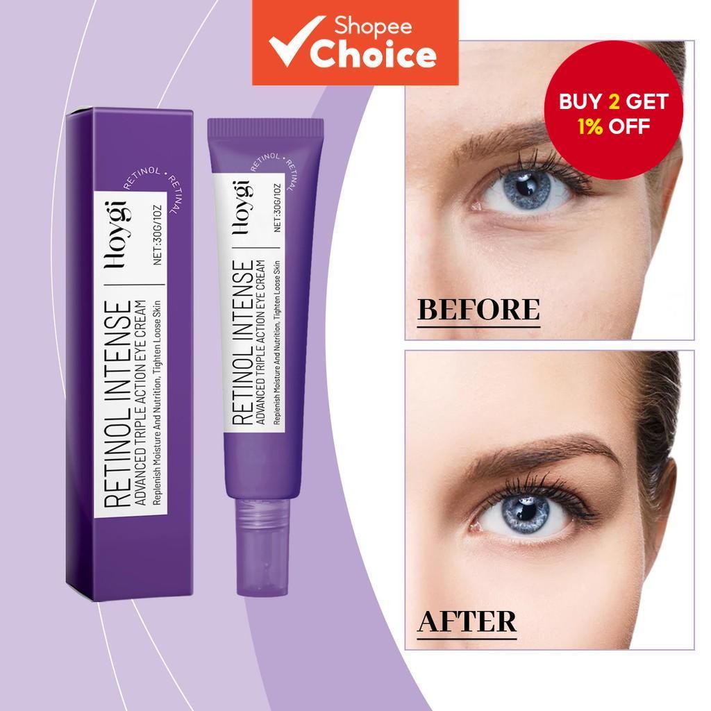 Retinol Eye Cream Lighten Dark Circles Remove Eye Bags Firming Lifting ...