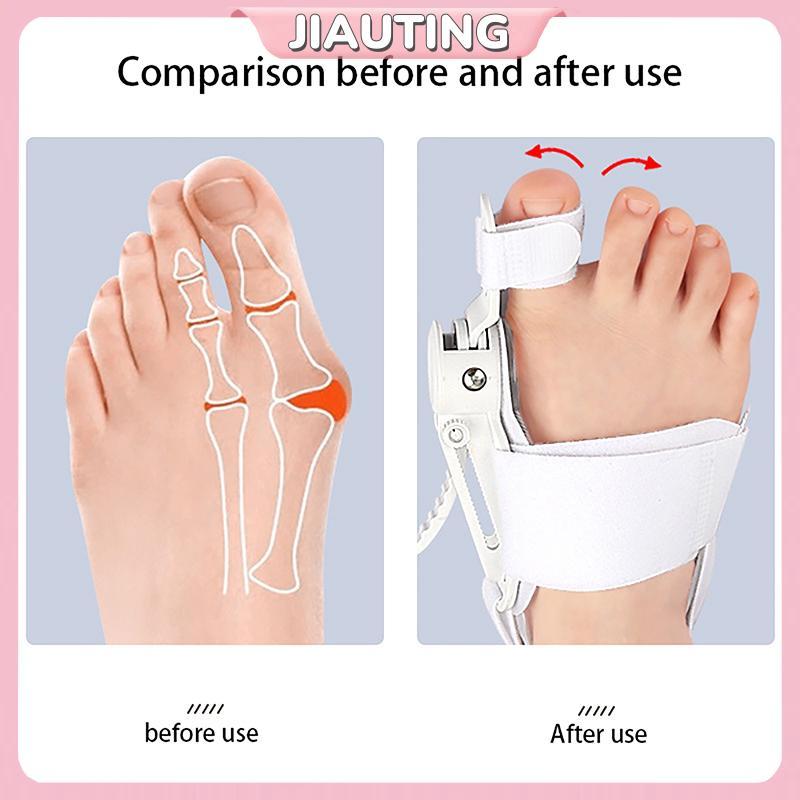 JIAUTING Thumb Eversion Orthotic Device Toe Separator Bunion Corrector ...