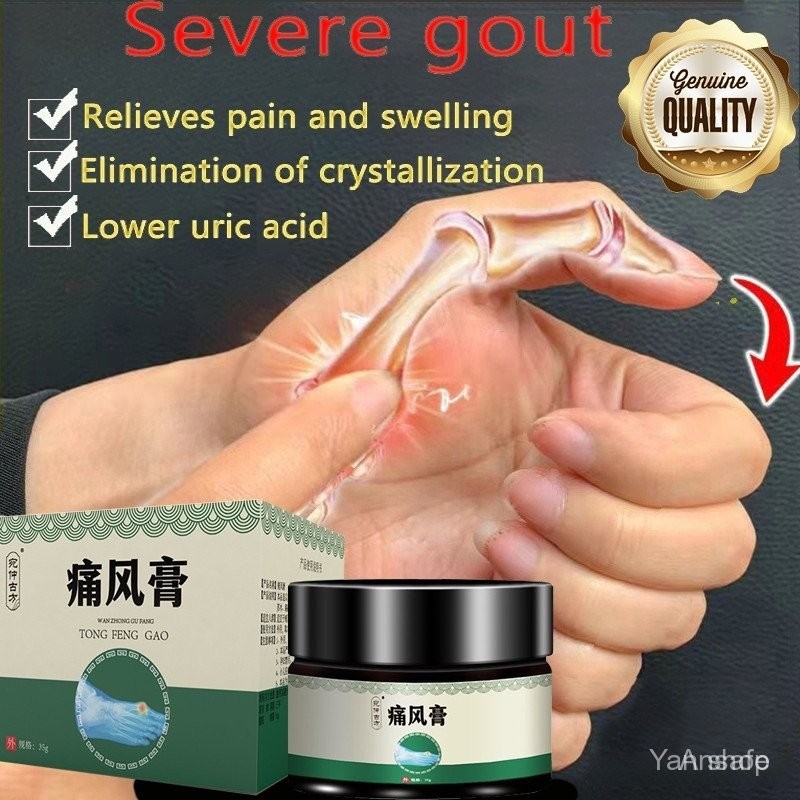 AnsafeChinese Herbal Medicine Gout Ointment Gout Cream ubat gout 35g ...