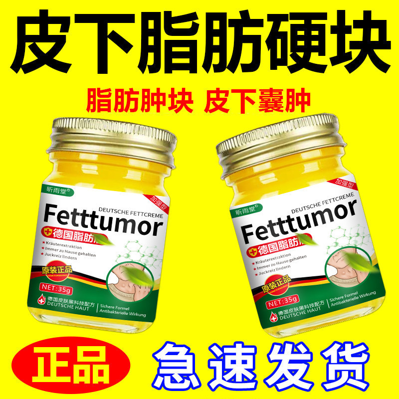 German Fat Kangzhengpin Lump Cream Fat Lingli Cream Subcutaneous Hard ...